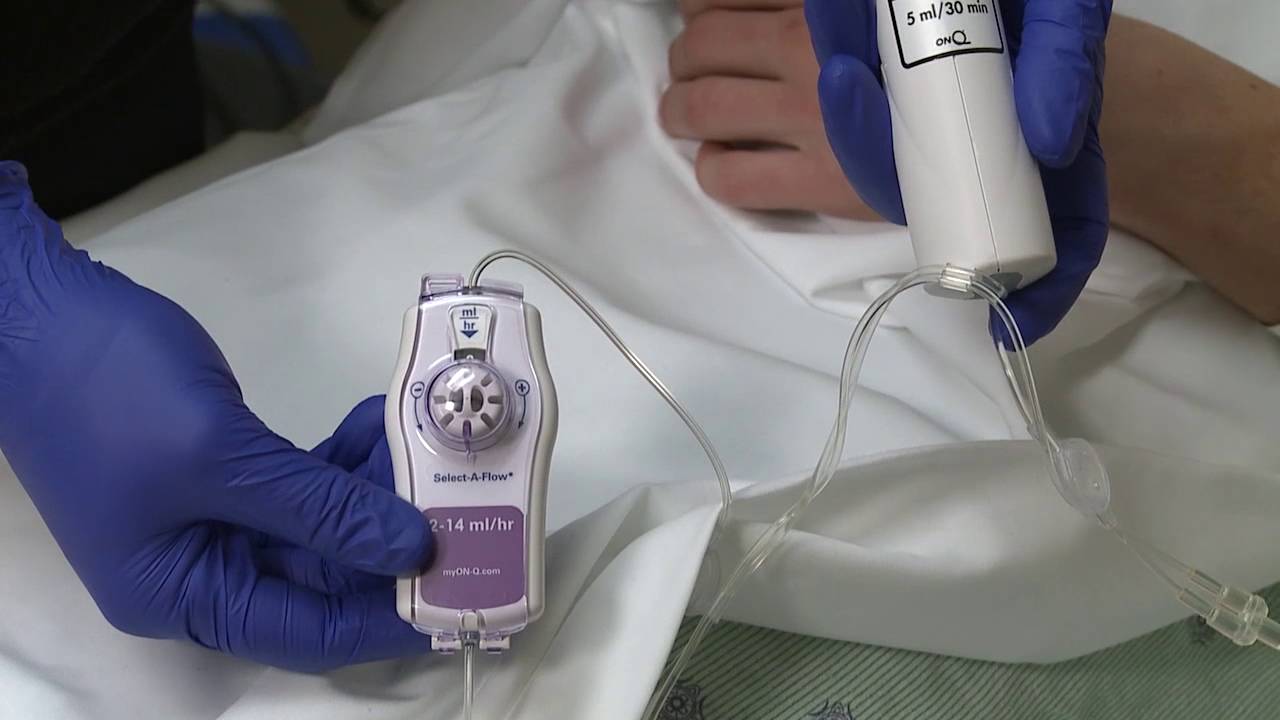 Using Your OnQ Pump
