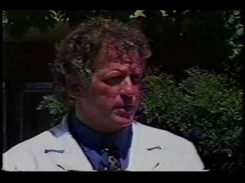 Los Angeles Plastic Surgeon Performs "Miracle Surgery" on Boy