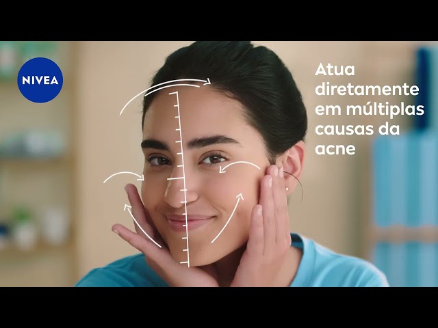 NIVEA Hidratante Facial Acne Control - Época Cosméticos | Época Cosméticos