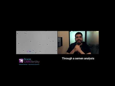 How is sperm quality assessed? Beacon CARE Fertility