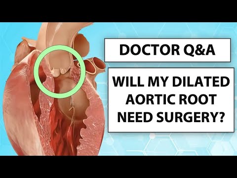 Doctor Q&A: The Progression and Surgery of Dilated Aortic Root Aneurysms with Dr. Luis Castro