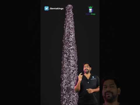 குவிந்து கிடக்கும் வைரக்கற்களா? - Diamond Burs | Dr. Karthikeyan| Denta Kings