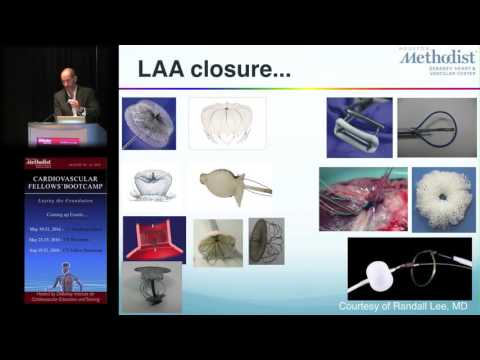 Atrial Fibrillation (Miguel Valderrábano, MD)