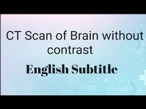 CT Scan of Brain without contrast (English)