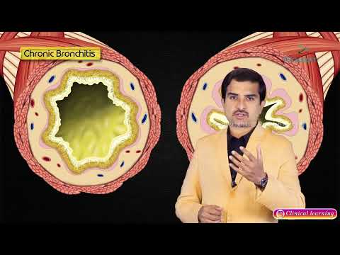 Bronchioles and alveoli: Structure and functions (preview) 🌬️🫁
