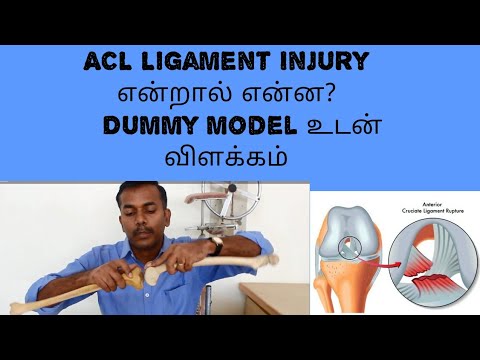 Ligament injury (Tamil), knee ligament injury, Ligament injury,Acl ligament injury(Tamil), ACL Cut