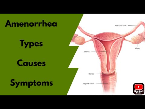 Amenorrhea, definition, types, causes, symptoms