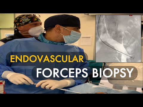 Interventional oncology: endovascular forceps biopsy after inferior vena cava filter deployment