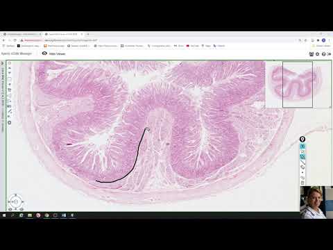duodenum