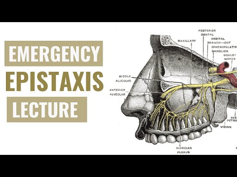 Epistaxis - Detailed explanation - Emergency Medicine