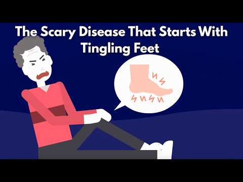Guillain-Barré Syndrome (GBS) Explained | Causes, Symptoms, Diagnosis, Treatment & Recovery