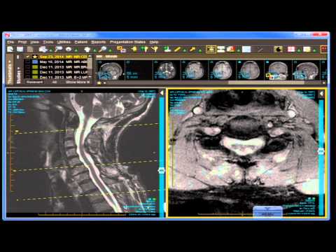 Image-Based Neurodiagnosis and Case Review