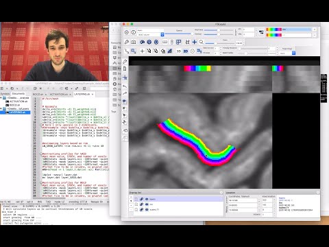 layer-fMRI analysis tutorial with BOLD and VASO