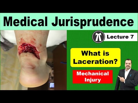 What is Laceration | Medical Jurisprudence Lecture 7 | Medico Legal Cases