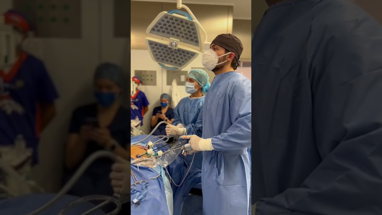 Apendicectomía laparoscópica