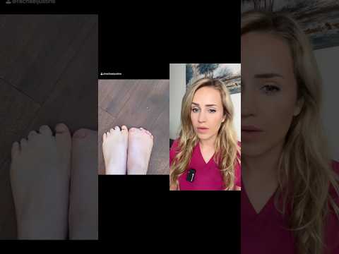 Doctor reacts: missing toes
