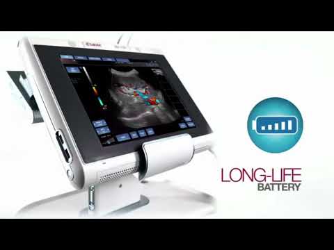 УЗИ аппарат Esaote MyLab One - купить в Москве по выгодной цене на MEDLIGA