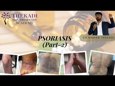 Homoeopathic medicines for psoriasis (PSORIASIS PART - 2)