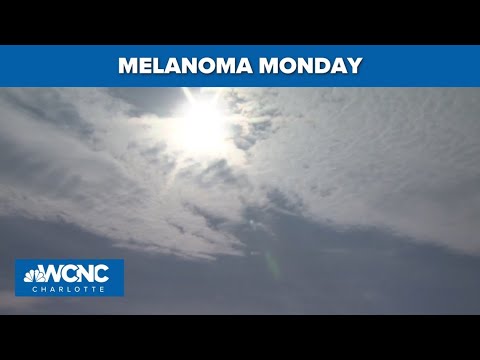 Doctor warns against sun exposure as weather warms