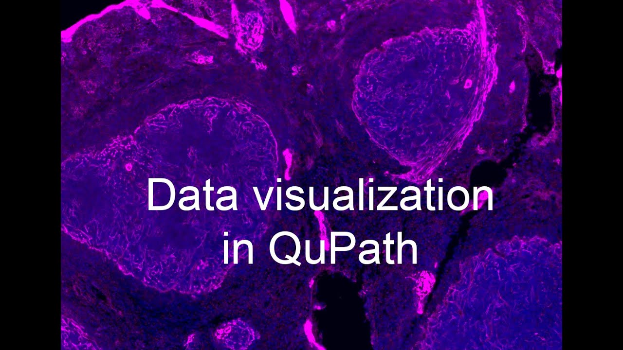 Data visualization in QuPath