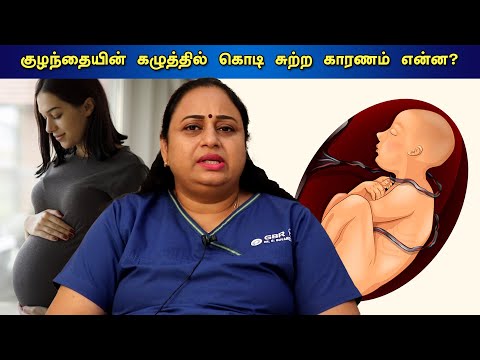 குழந்தை கழுத்தில் கொடி சுற்ற காரணம் என்ன? | cord around fetal neck during pregnancy | GBR