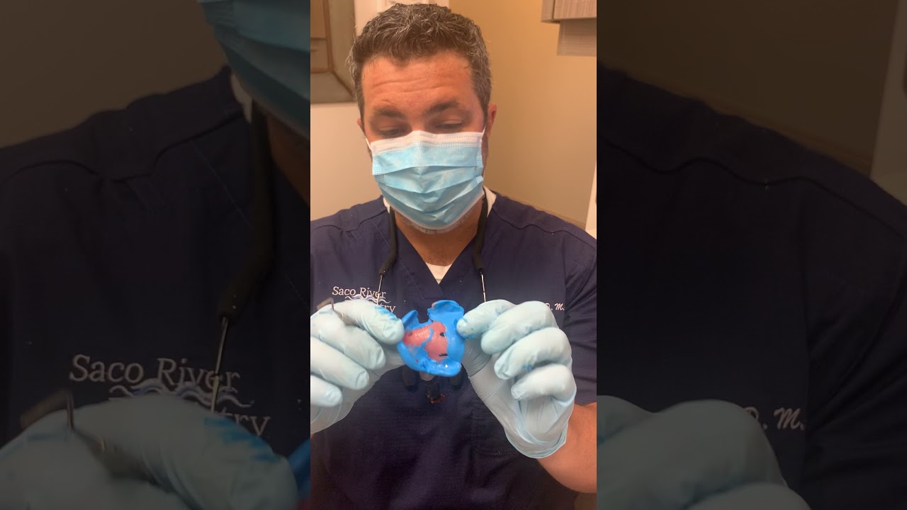 Complete Denture Troubleshooting #5