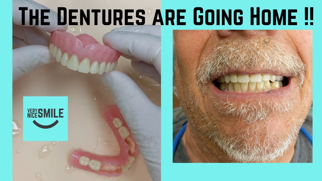Denture delivery visit
