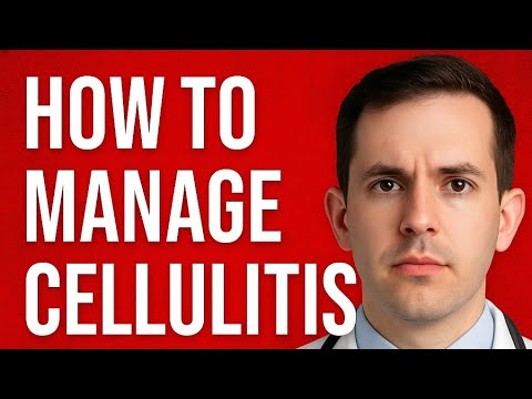 How to Manage Cellulitis: Diagnosis, Treatment, and When to Worry (MD Talk)