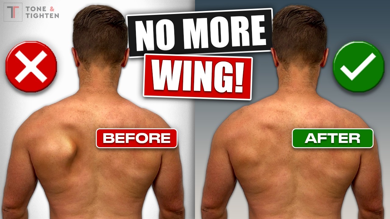 Fix Scapular Winging FOR GOOD! [Shoulder Blade Exercises]