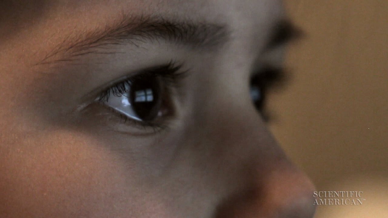 Tracing a Gaze to Understand Language Delays