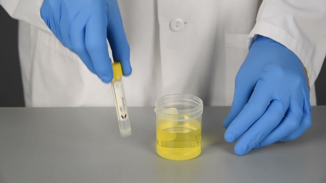 Simplify Urine Collection with Copan's UriSponge® System