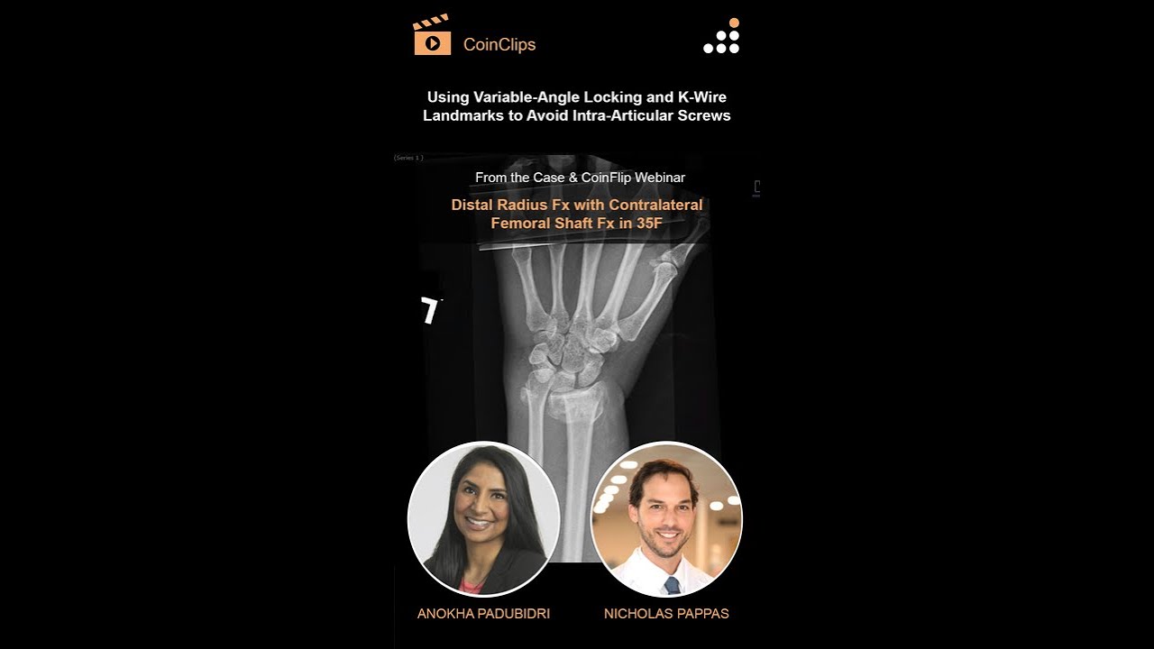 Using Variable-Angle Locking and K-Wire Landmarks to Avoid Intra-Articular Screws