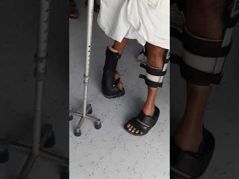 My Care Prosthetics And Orthotics - Manufacturer of Orthopedic Shoes ...