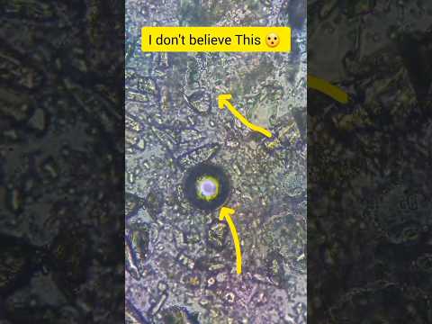 expired medicine under microscope #shorts #subscribe #medicine #microscope