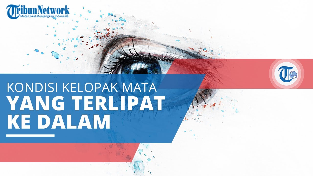 Entropion, Kondisi Kelopak Mata yang Terlipat ke Arah Dalam Sehingga ...