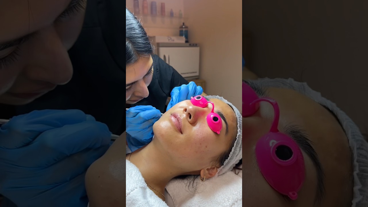 extraction facials for congested skin #facial #korean #skincare
