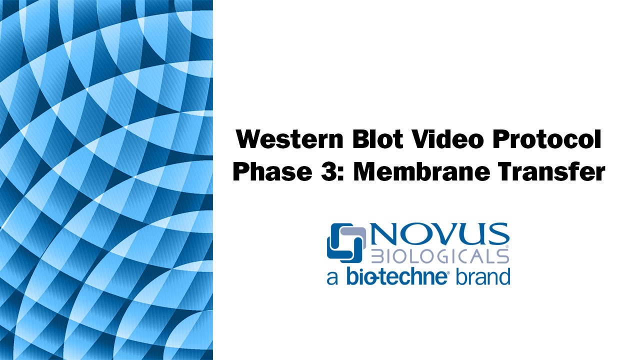 Protein Transfer from Gel to Membrane in Western Blot | Bio-Techne