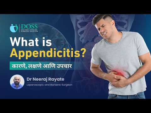 What is Appendicitis? | Appendix म्हणजे काय? कारणे, लक्षणे आणि उपचार | Dr Neeraj Rayate: Doss India