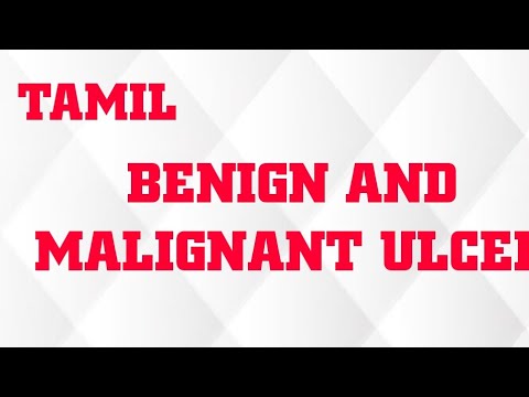 BENIGN AND MALIGNANT TUMOUR IN TAMIL/DIFFERENT BETWEEN THEM/CLINICAL FEATURES