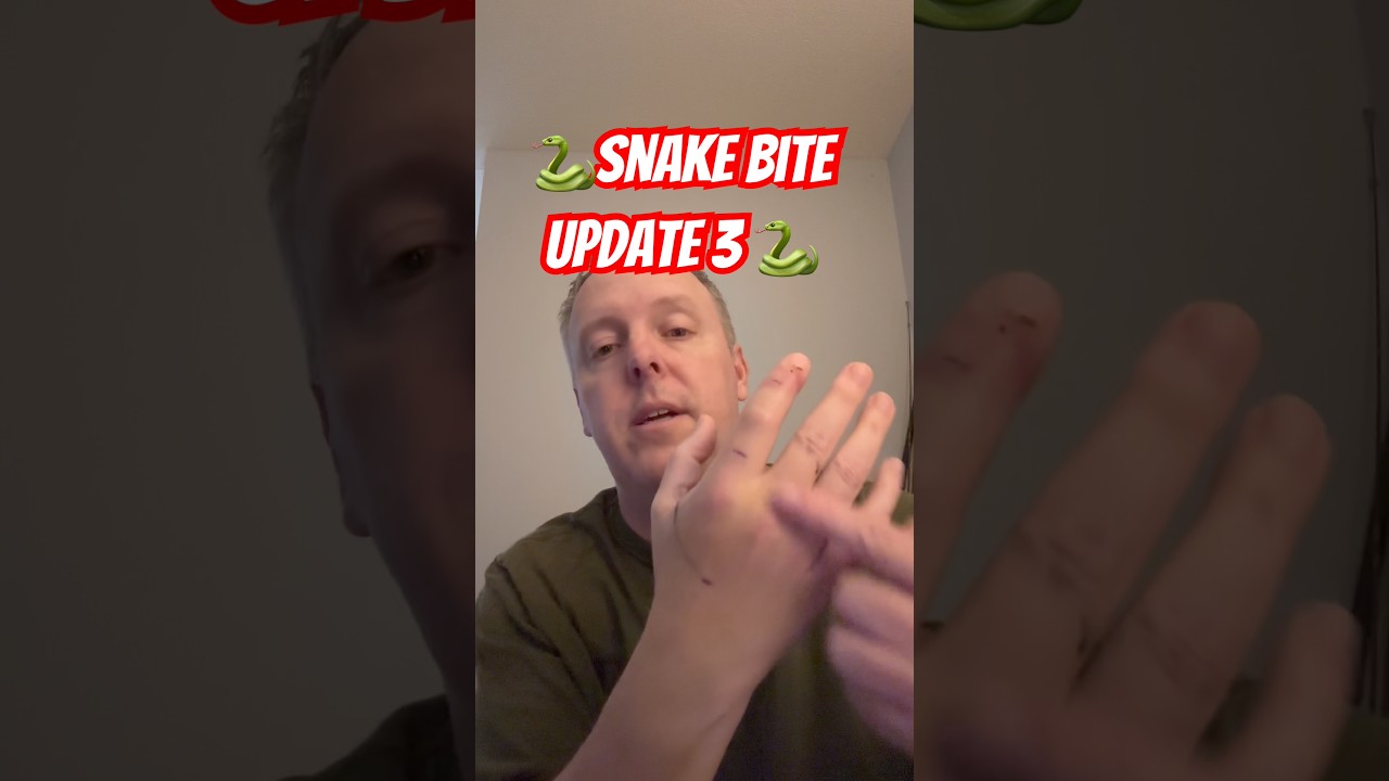 Snake Bite Update 3