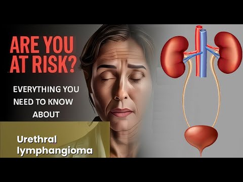 Urethral lymphangioma Explained Causes, Symptoms and Treatment, All Insights