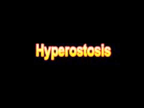 What Is The Definition Of Hyperostosis - Medical Dictionary Free Online Terms