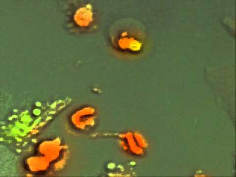 Killer T cells and cancer - Nature Medicine - Video.wmv