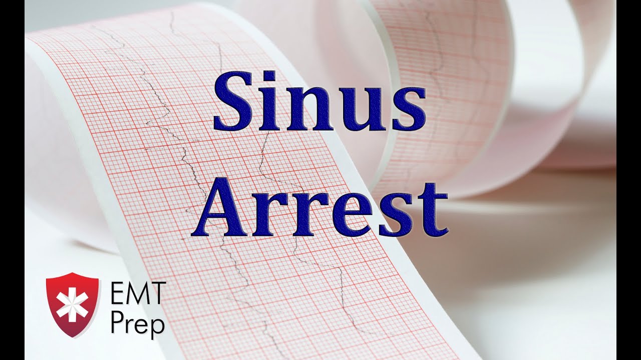 Sinus Arrest ECG - EMTprep.com