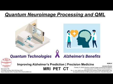 Quantum Neuroimage Processing and QML for Alzheimer's Disease