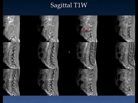 MR Safety Week 2018 #1: Low SAR Protocols