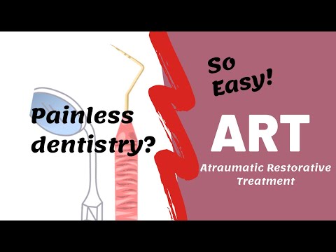 DENTAL PROCEDURES | The art behind ART | Atraumatic Restorative Treatment