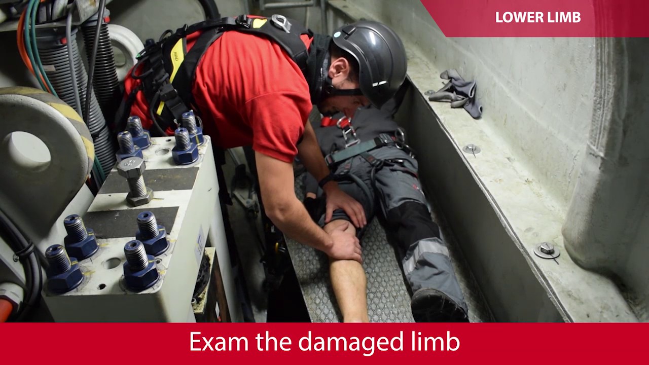 First aid. What to do in case of extremity fracture in a wind turbine
