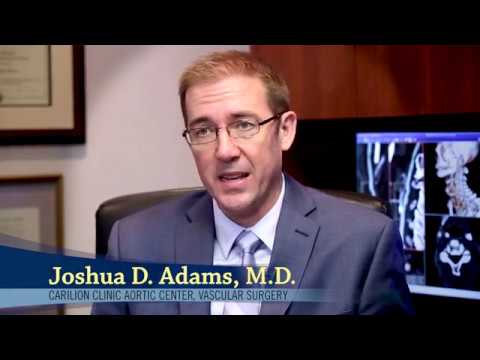 TCAR at Carilion Clinic for Carotid Artery Disease