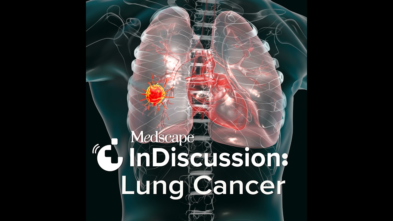 S3 Episode 2: Improving Lung Cancer Patient Care Through Collaboration, Psychology, and Communica...